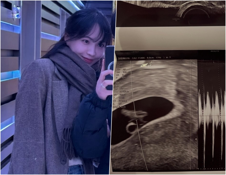 '마약 투약 논란' 서민재, 임신 발표인가 폭로인가 "아빠 된 거 축하해 OOO"-pickcon