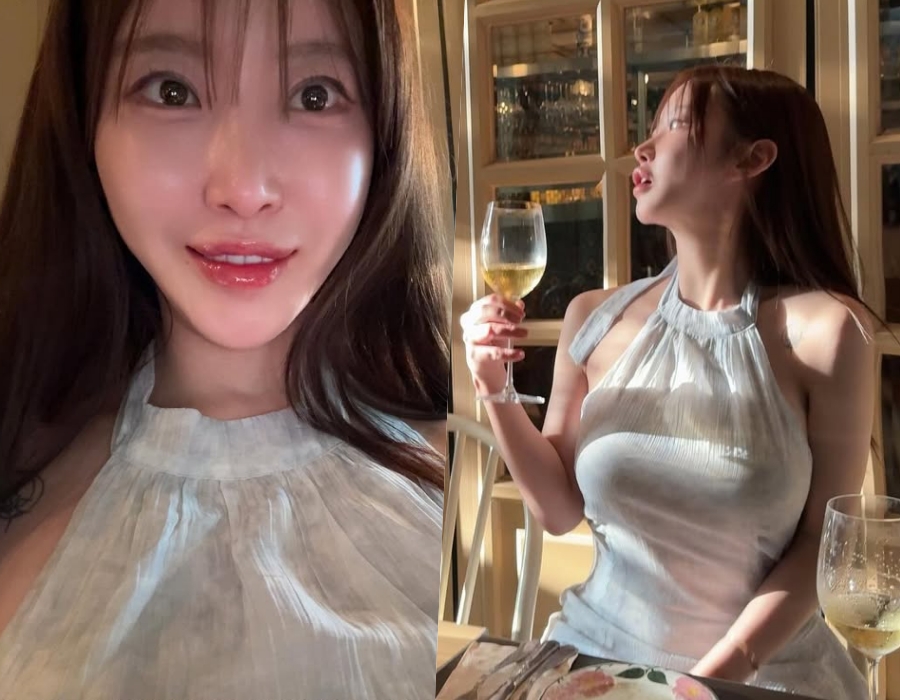 '뽀뽀녀' 20기 정숙, 글래머러스 핫보디로 치얼스…앞니 8개 라미네이트 고백-pickcon